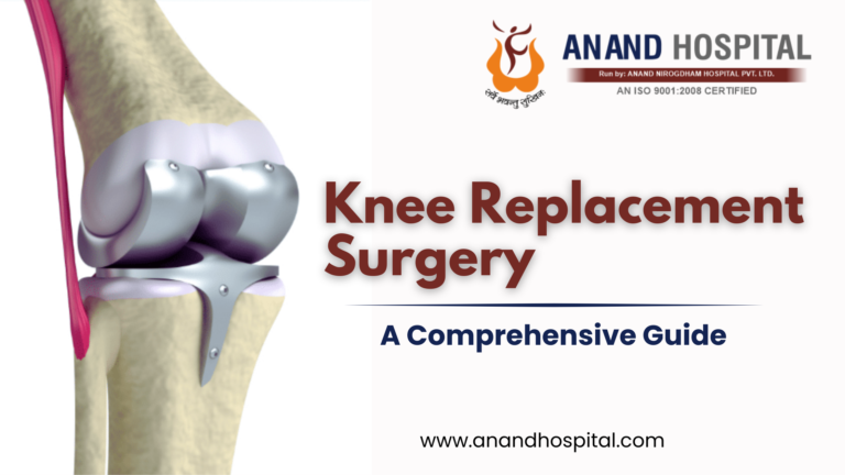 Knee Replacement Surgery: A Comprehensive Guide - Anand Hospital