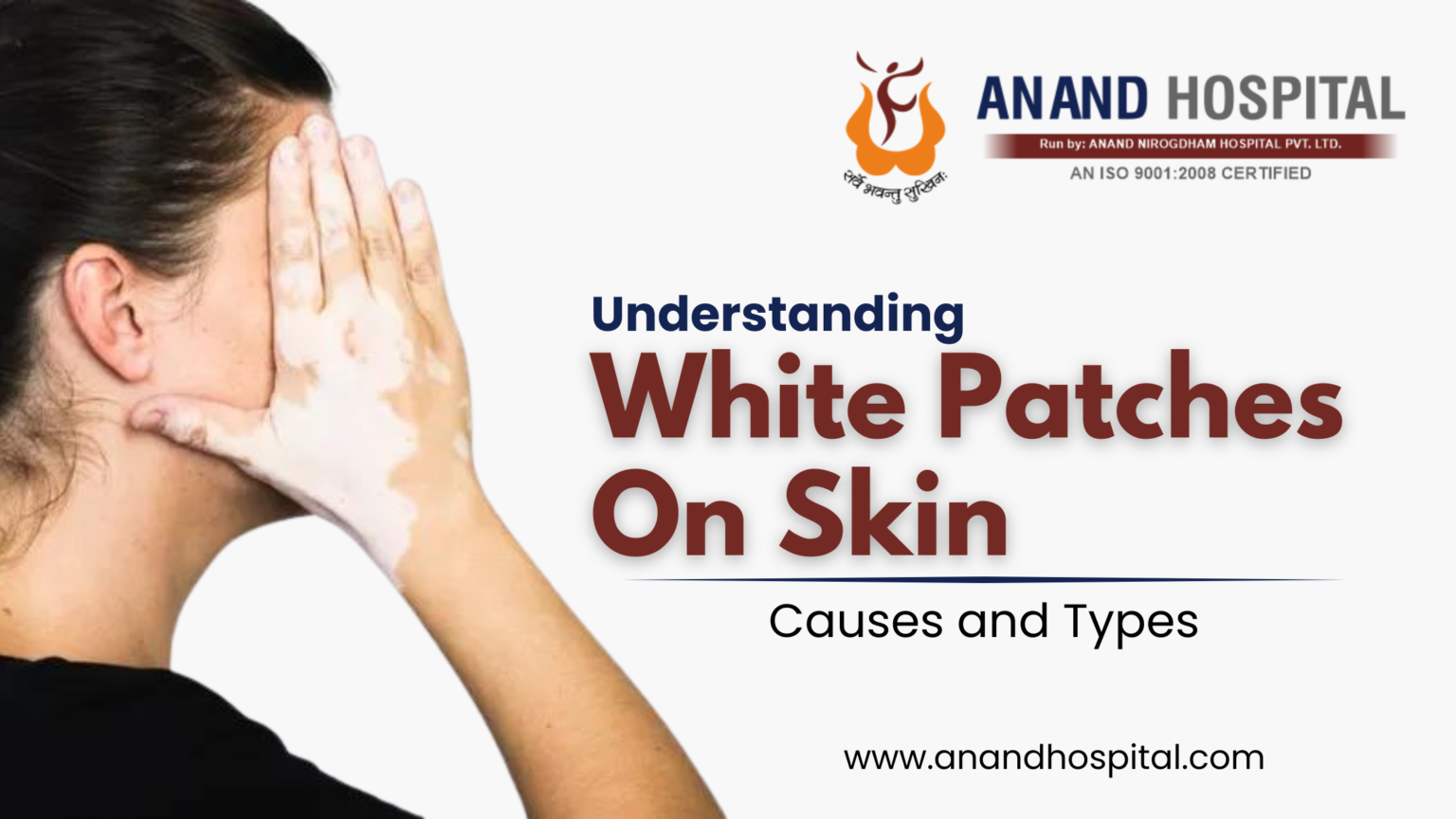 Understanding White Patches on Skin: Causes and Types - Anand Hospital