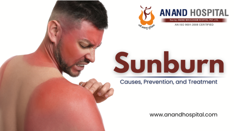 SunBurn: Causes, Prevention, and Treatment - Anand Hospital